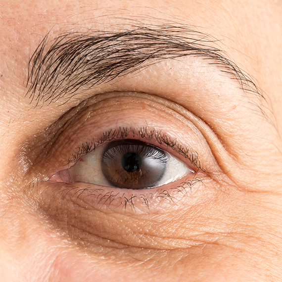 Policlinica ICD | Unidad Estética Rejuvenecimiento Facial